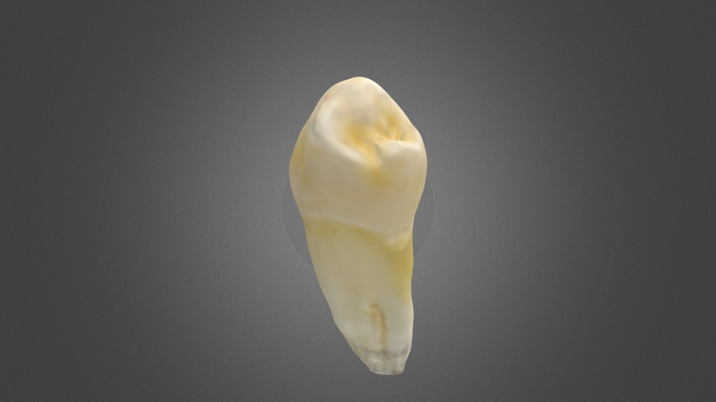 Tooth - 3D model by bobbymcgoo [cf50ed5] - Sketchfab