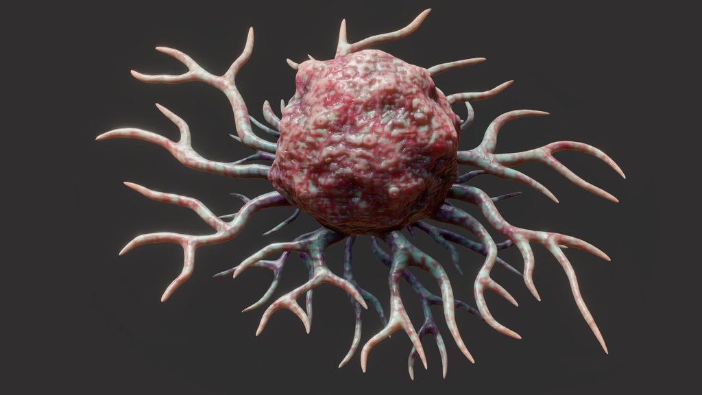 Cancer - A 3D model collection by burakilbey58 - Sketchfab