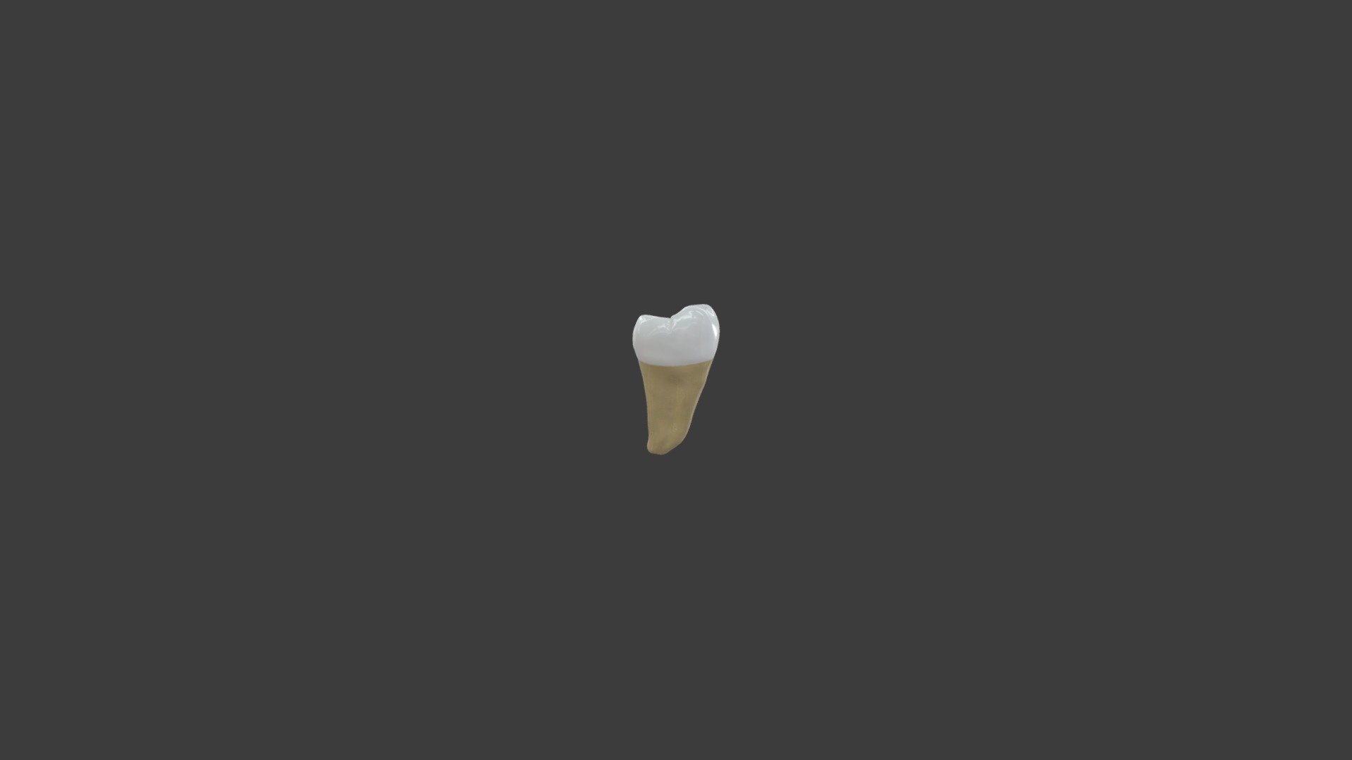 Mandibular 3rd Molar Left - 3D model by Ahmed Mahrous (@drahedmahrous ...
