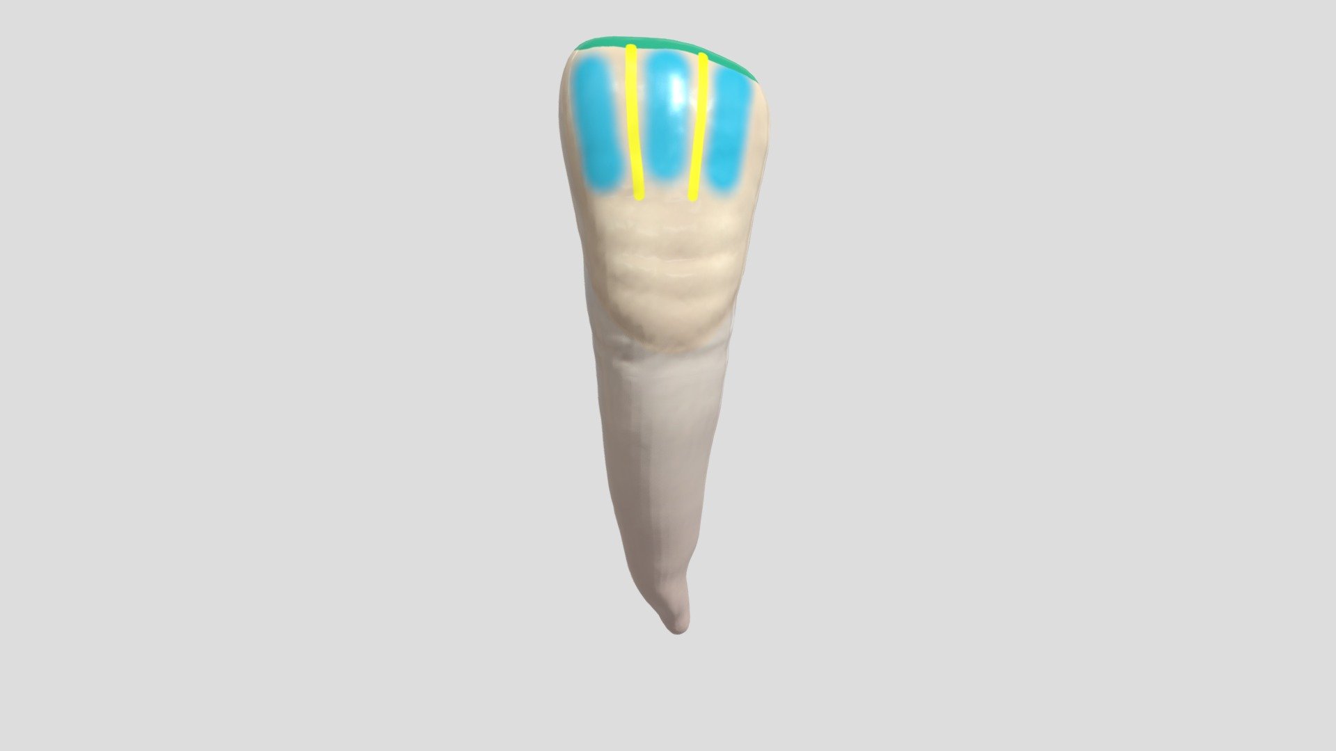 Maxillary lateral incisor anatomy features - 3D model by Virtual Dental ...