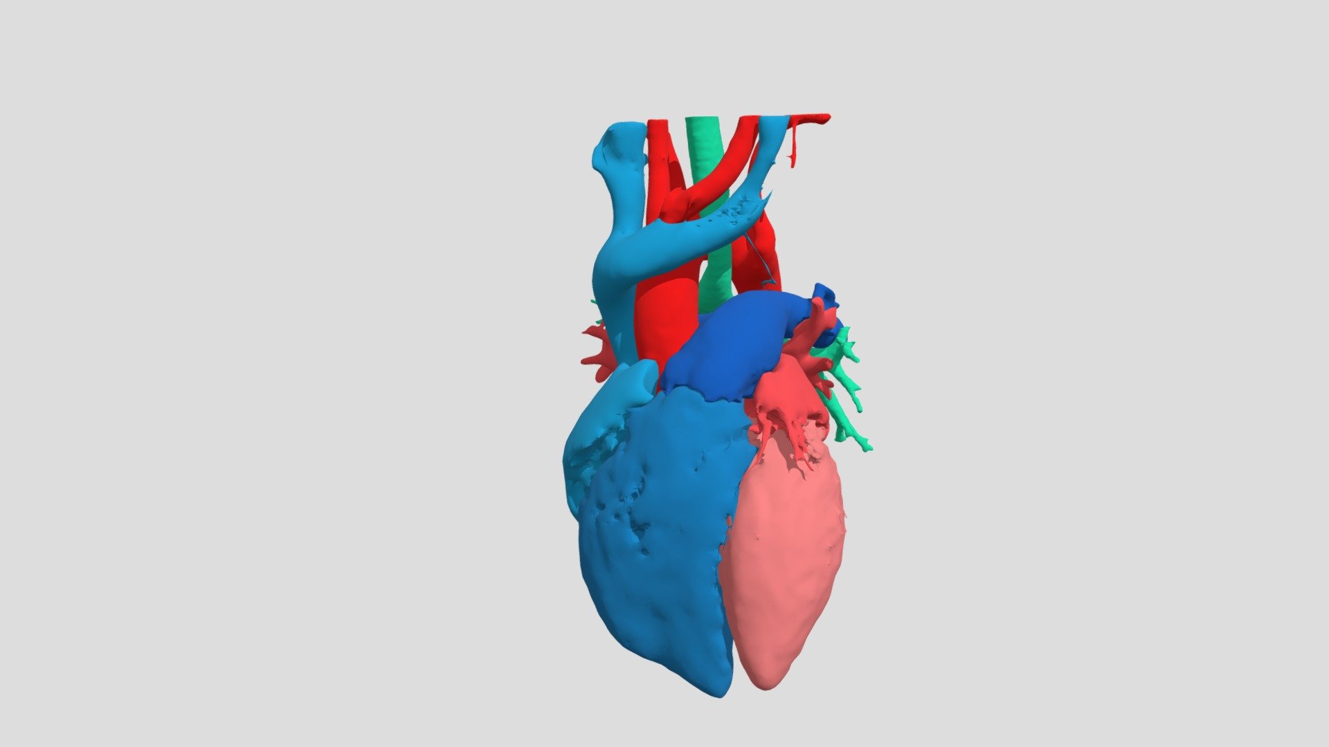 Right Aortic Arch with Vascular Ring (S0378) - 3D model by NCH Advanced ...