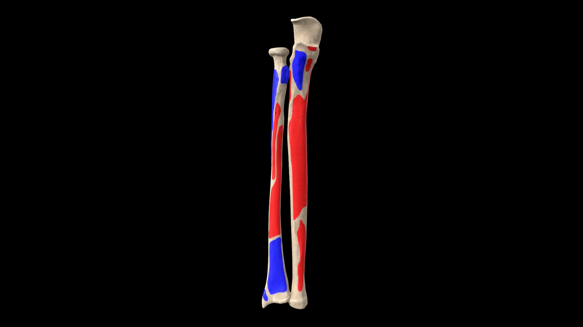 Landmarks of Radius and Ulna bones of forearm - 3D model by Anatomy by ...