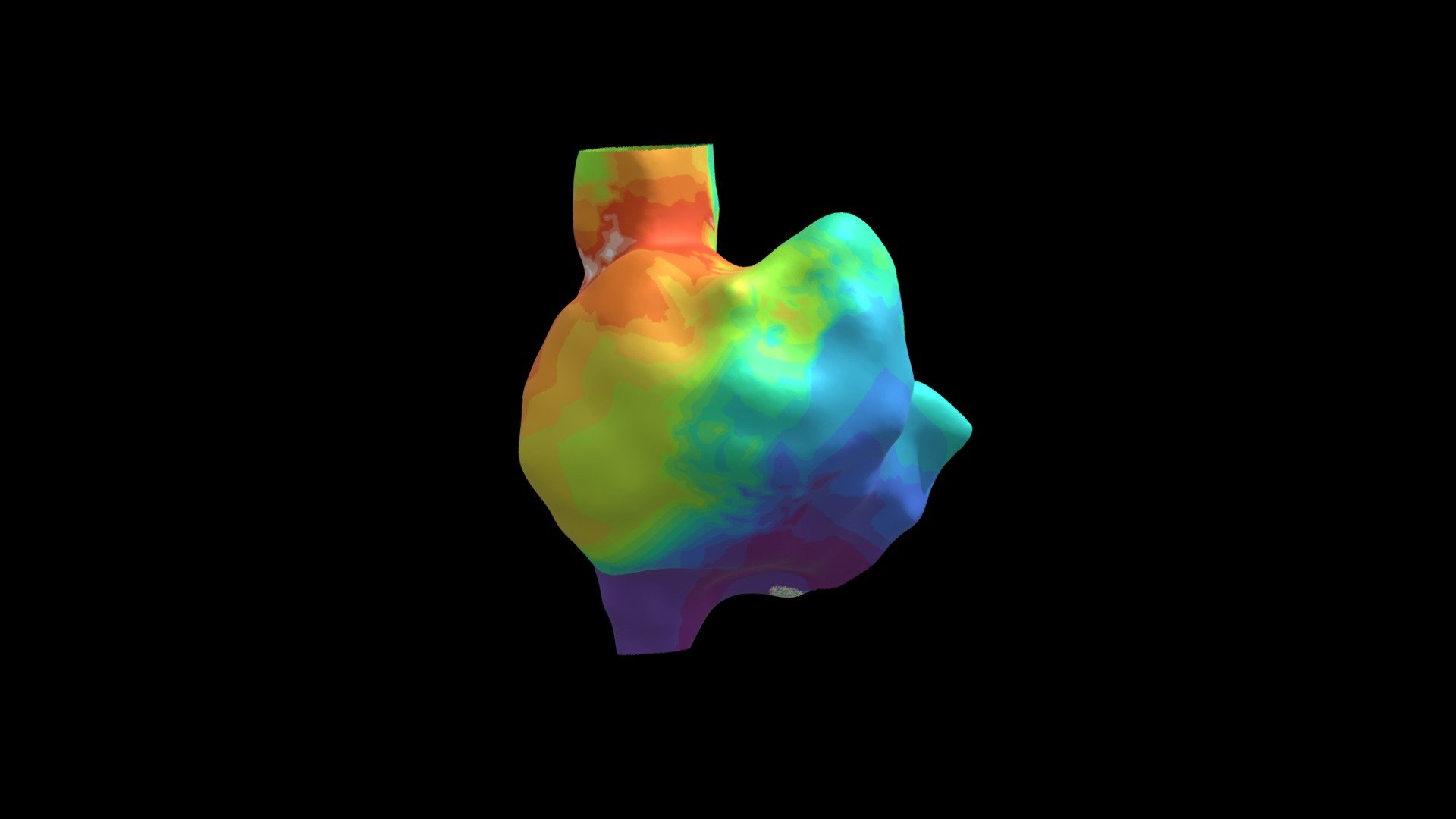 Sinus Rhythm - RA (HC) - 3D model by drj (@drjameswinter) [d178985 ...