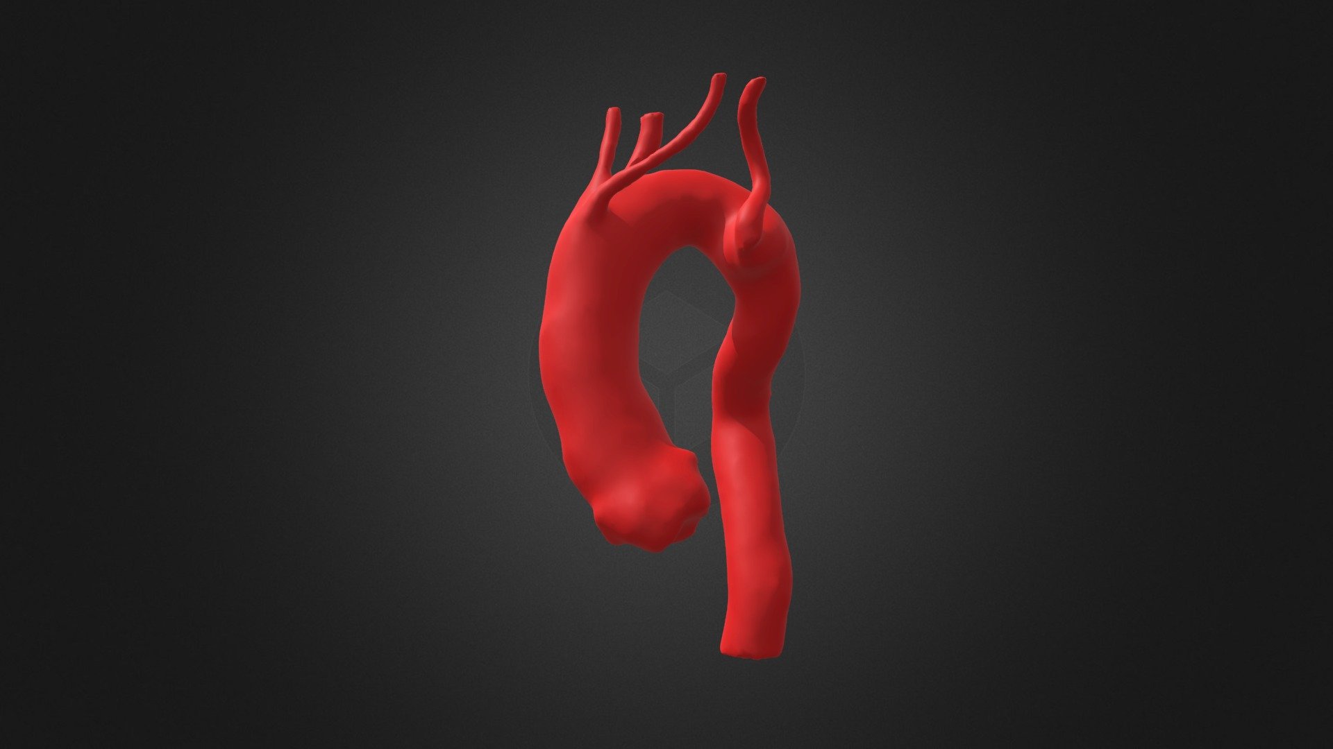 Right-Sided Aortic Arch with 4-Vessel Branch - 3D model by yuhuihuang ...