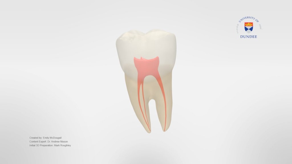 Mandibular Second Molar - Endodontic - 3D model by University of Dundee ...