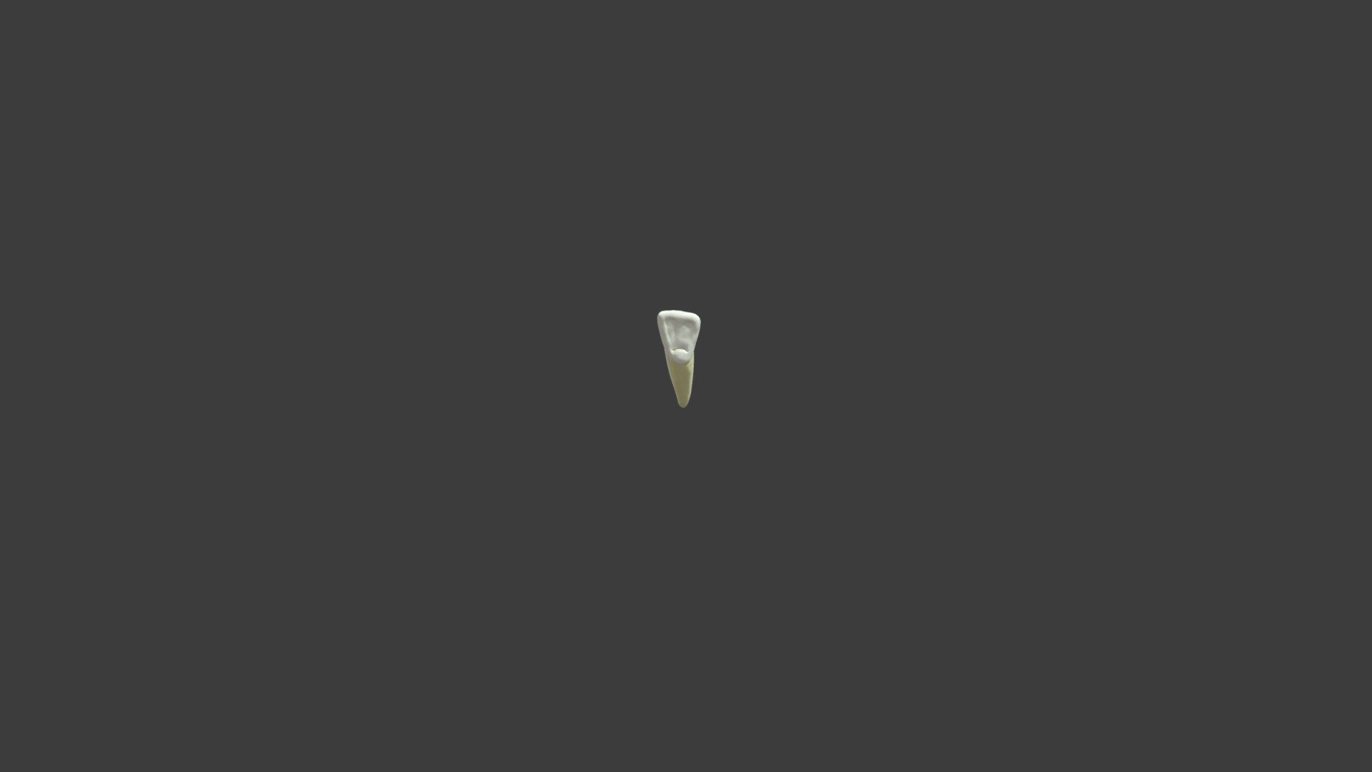 Cingulum rest U shape - 3D model by Ahmed Mahrous (@drahedmahrous ...