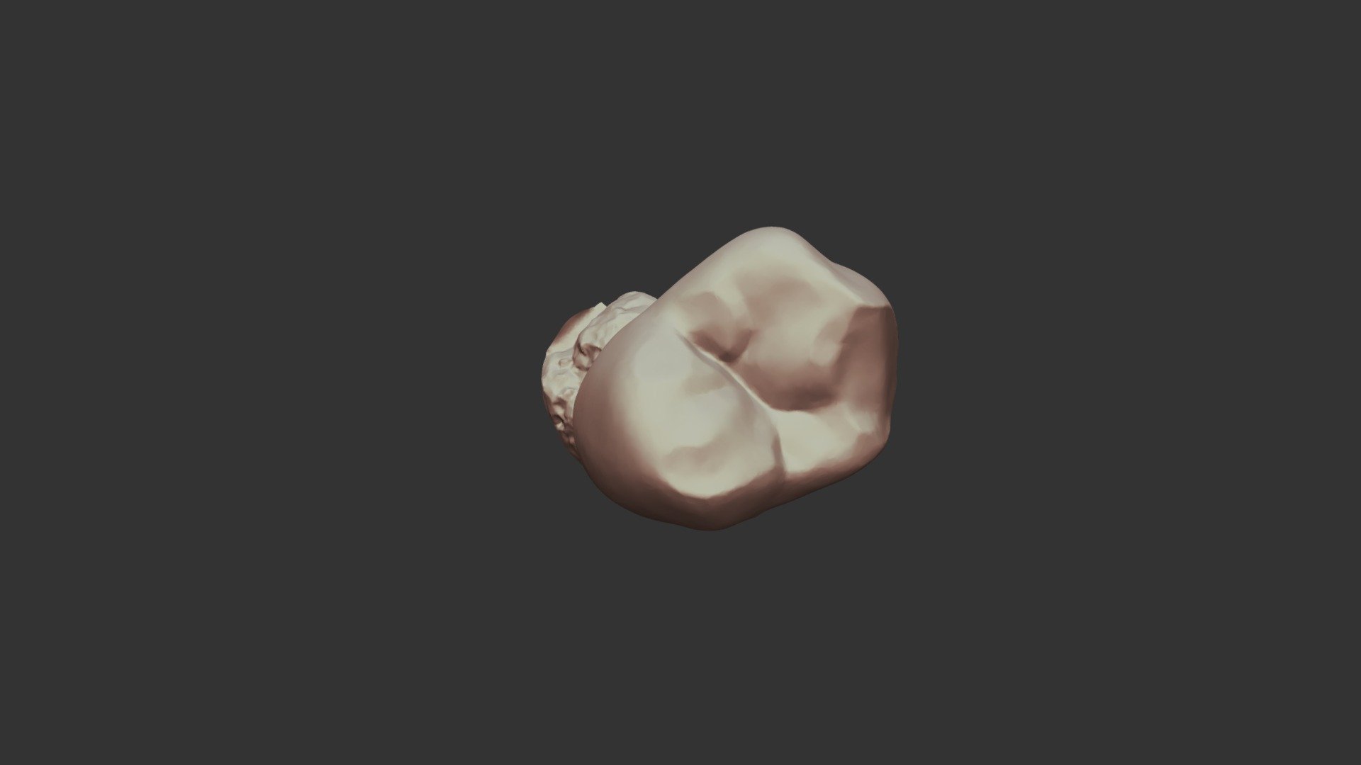 Tooth 13, Group 16, Scanner 2 - 3D model by UMdental [d2263b2] - Sketchfab