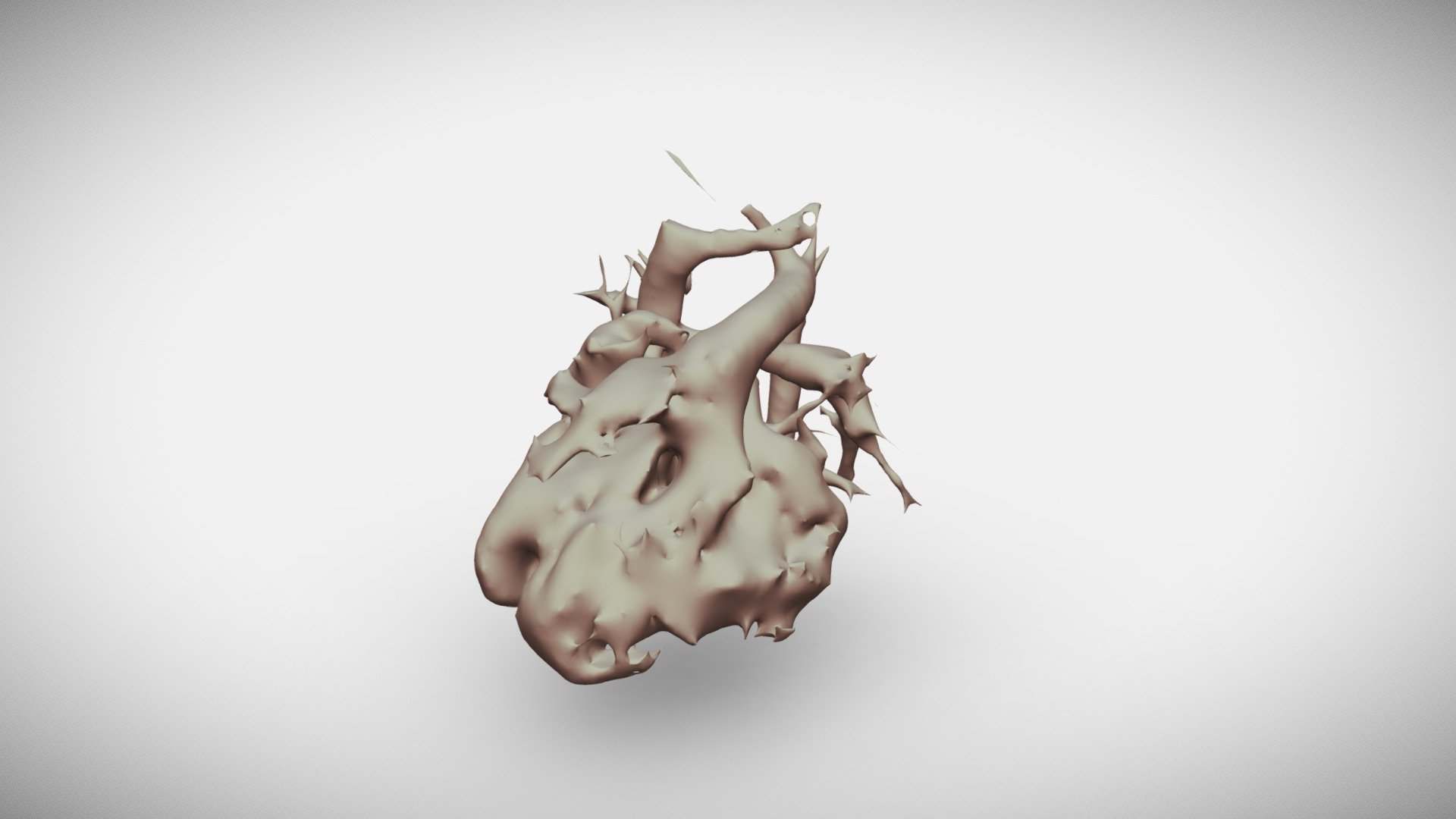 VSD - 3D model by Imre J. Barabás, MD, M.Sc. (@Uzzias18) [d29d147 ...
