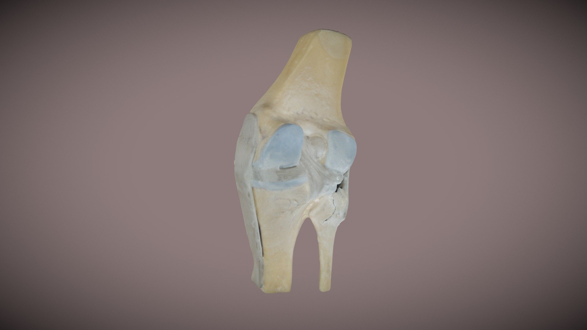 Internal Knee Joint - 3D model by OrJames Labs (@orjameslabs) [d2c3110 ...