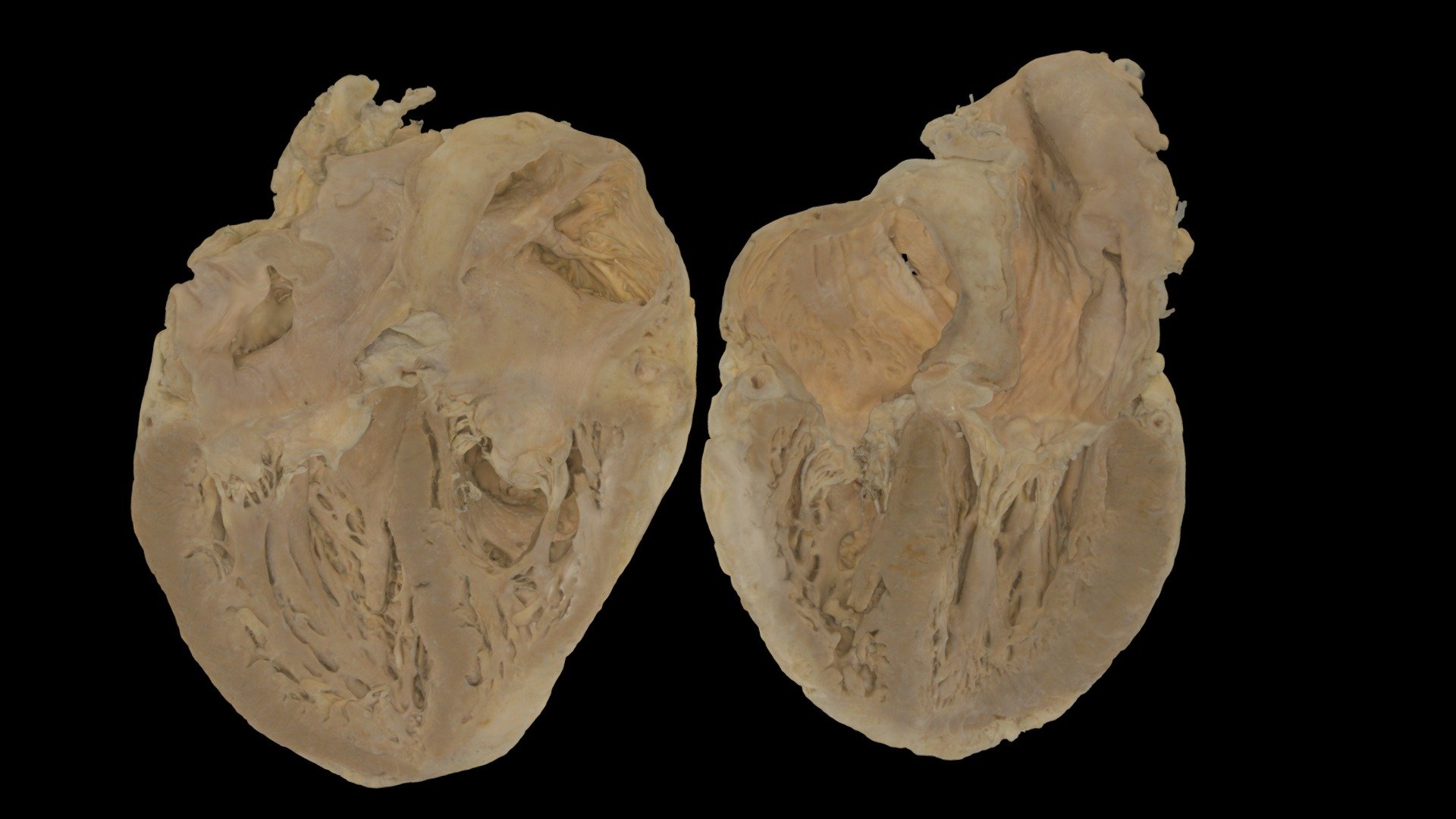 Plastinated Human Heart #0010 - Download Free 3D model by ...