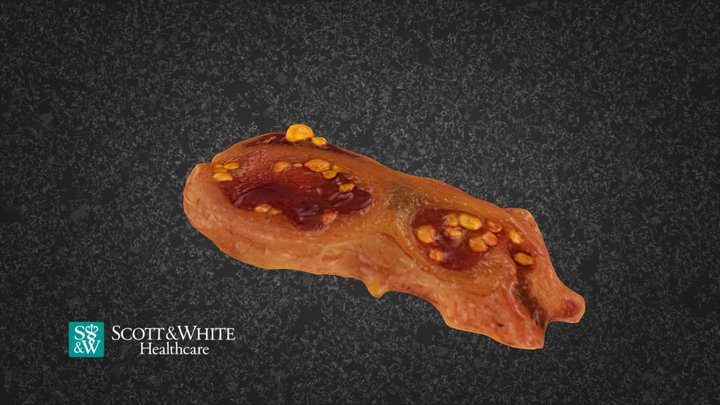 Gallbladder 3D models - Sketchfab