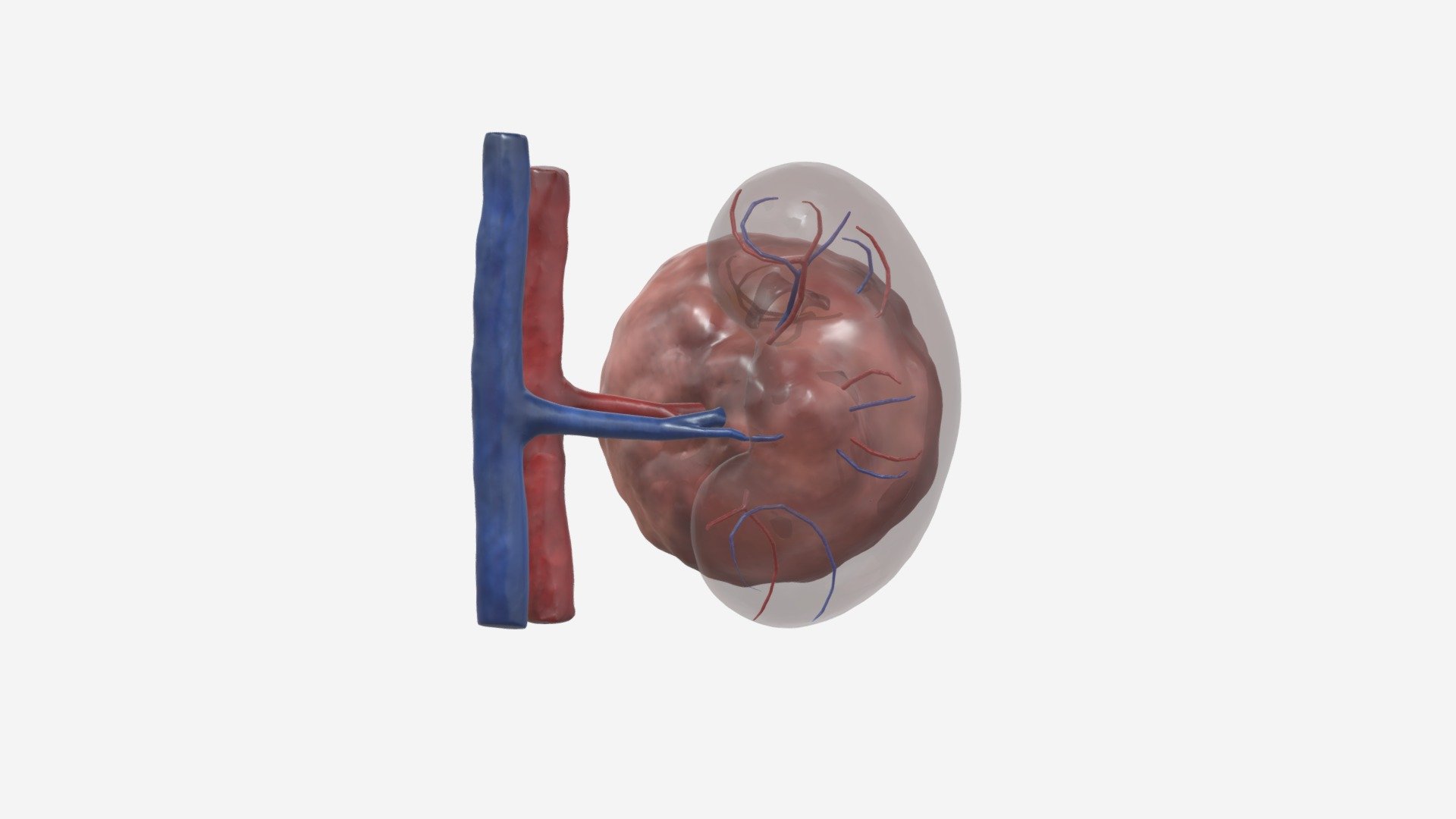 Kidney Cancer - Medium Sized Tumour - 3D model by cc94 [d489fff ...