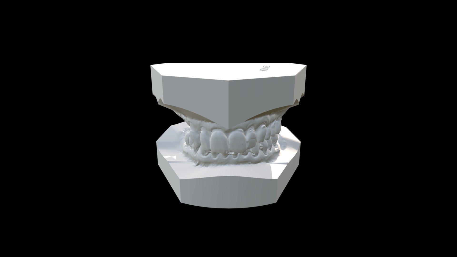 Case LL Occlusion - 3D model by mdentalmargeaux [d4ed0e5] - Sketchfab