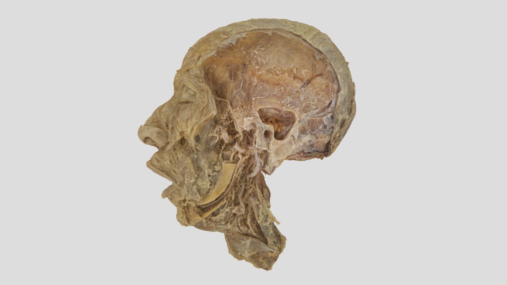 Human Head - scan of real human specimen - 3D model by www.enatom.com ...
