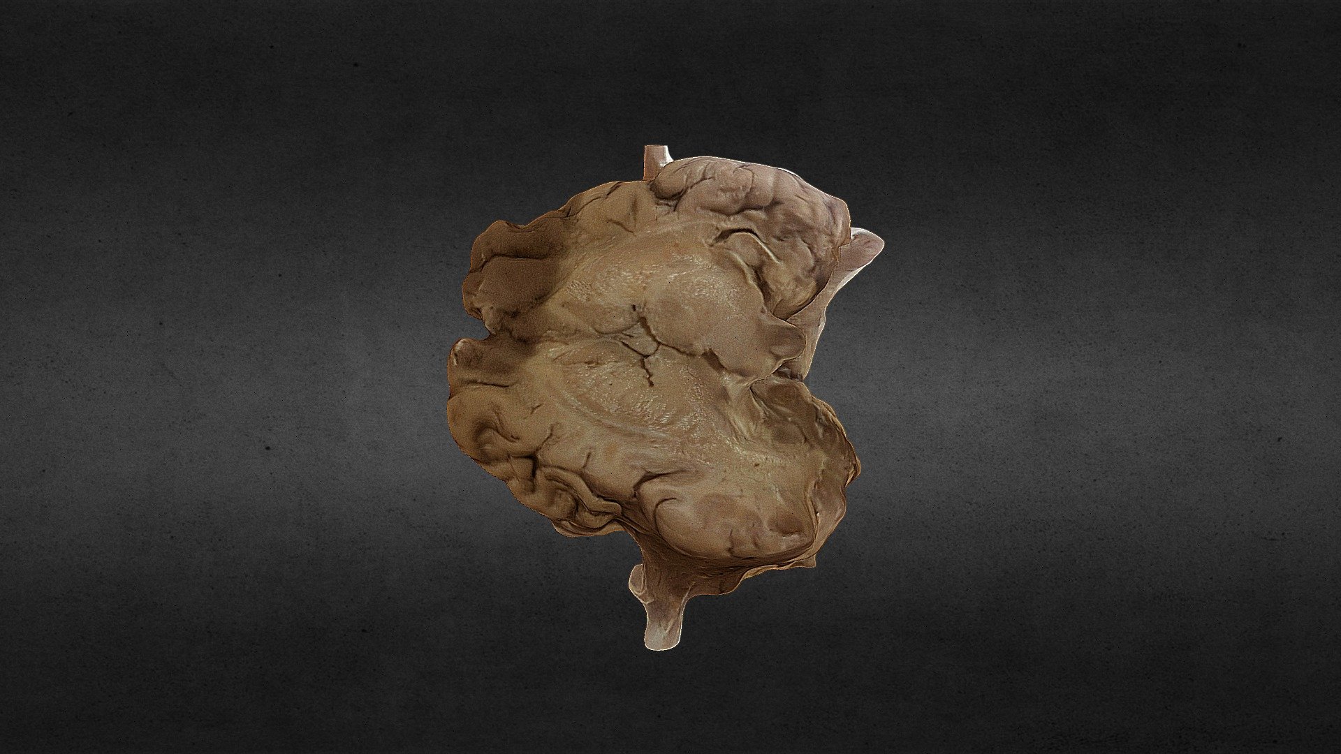 Corte axial del encéfalo - 3D model by AnatomiaG5 [d59ae0c] - Sketchfab