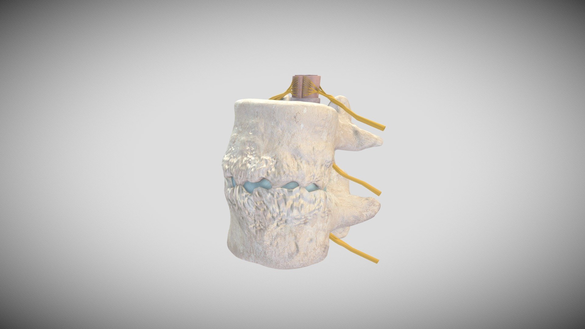 Syndesmophyte Formation V002 - 3D model by imiridley [d5f491a] - Sketchfab
