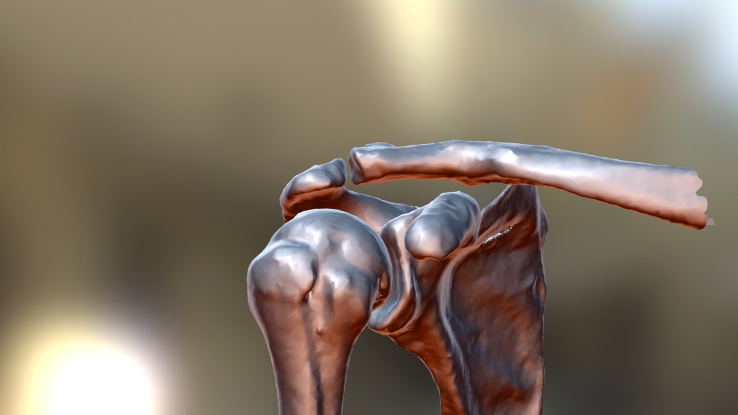 Shoulder Instability08 - 3D model by orto3d [d634eb5] - Sketchfab