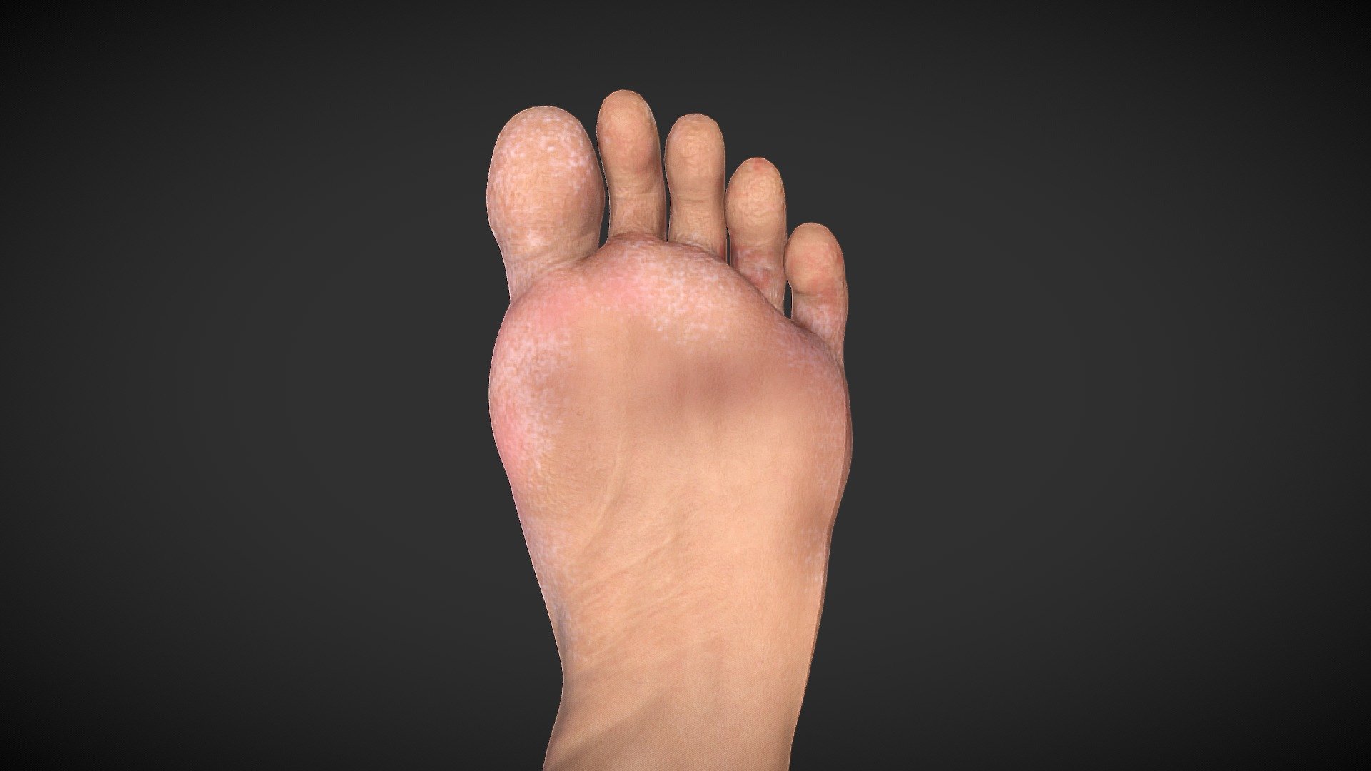 Athlete's foot - Buy Royalty Free 3D model by Ebers [d6971ee ...