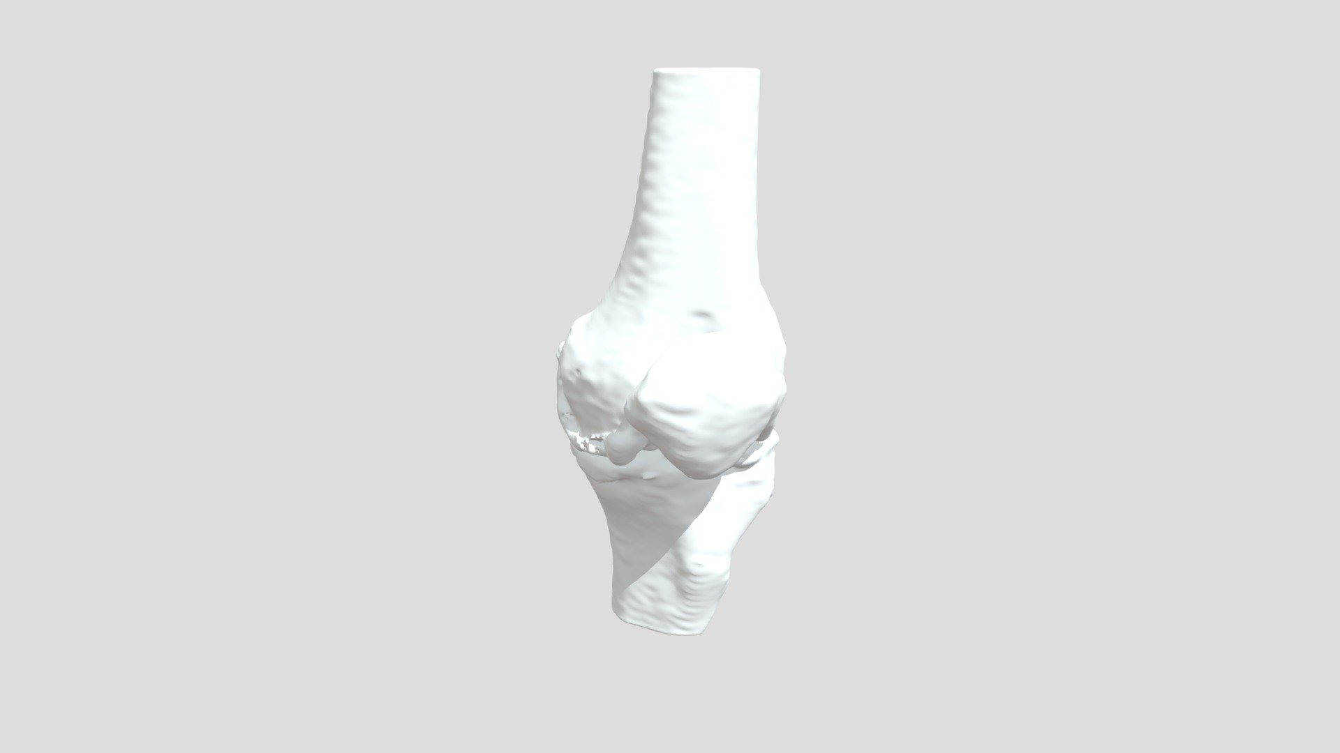 Segmentation T P Lt Bone - 3D model by curisdata.science [d719cbf ...