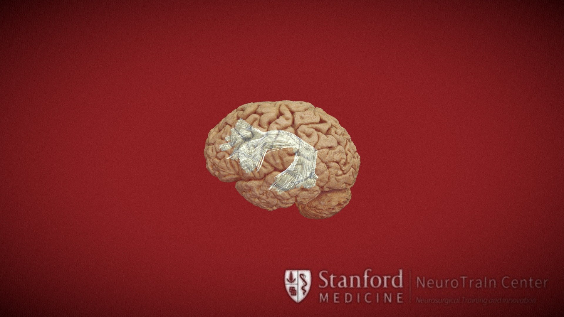 All Brain AF - 3D model by vv (@verav) [d7372a3] - Sketchfab