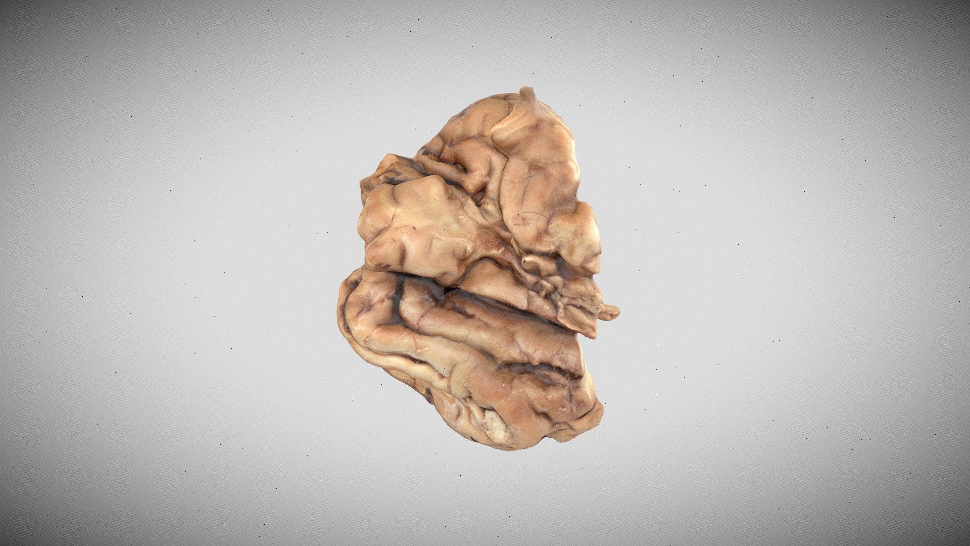 CORTE CORONAL DEL ENCÉFALO- CI - 3D model by ANATOMIA III_TERCERO A ...