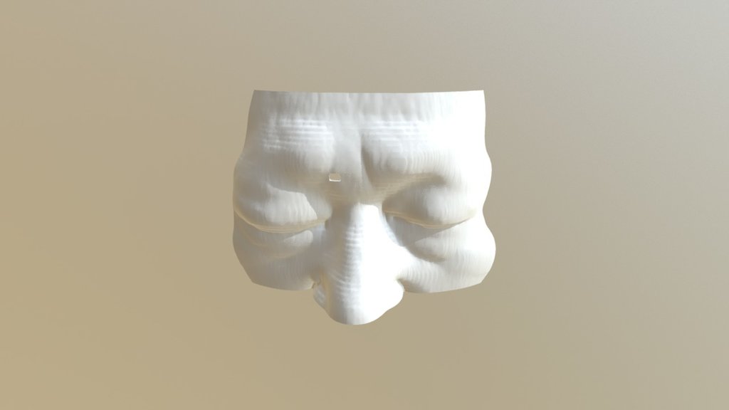 Recurrent frontal sinusitis - Ant. Face - 3D model by skyf16 [d760293 ...