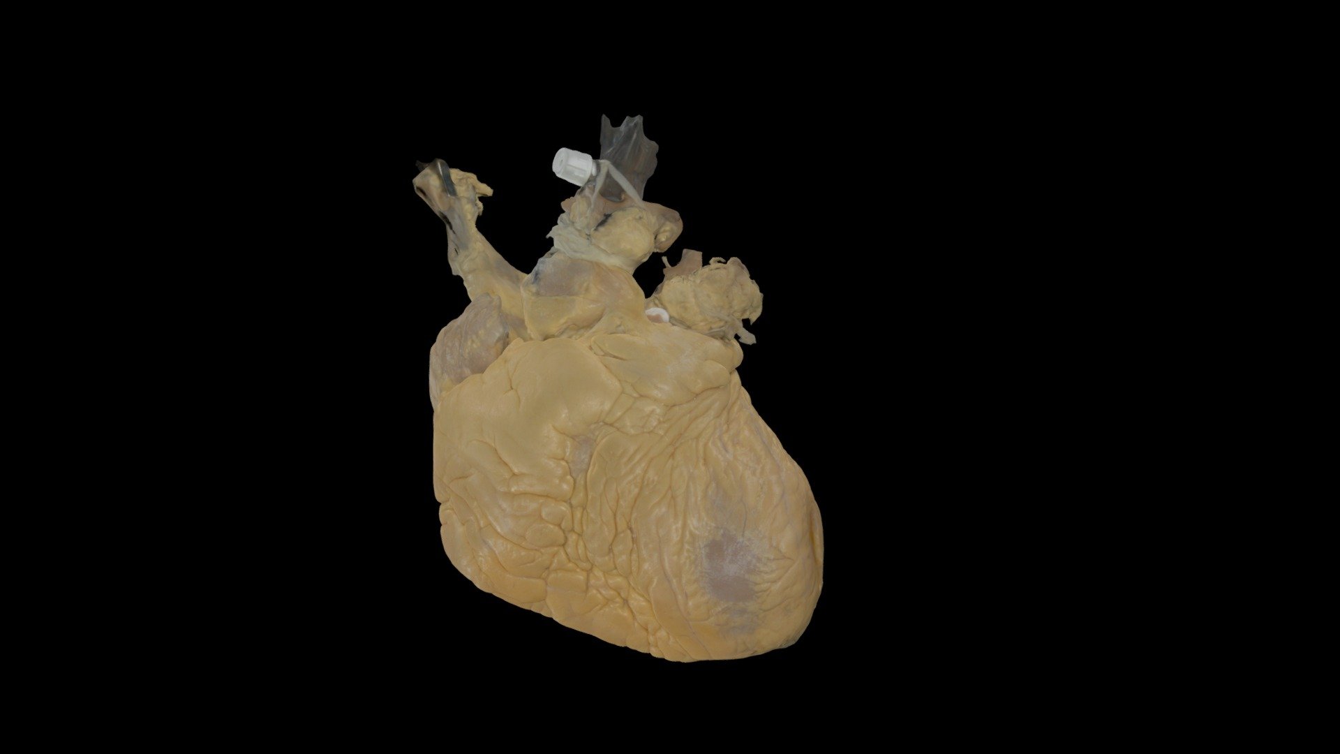 Fixed Human Heart Donation #115 - Download Free 3D model by ...