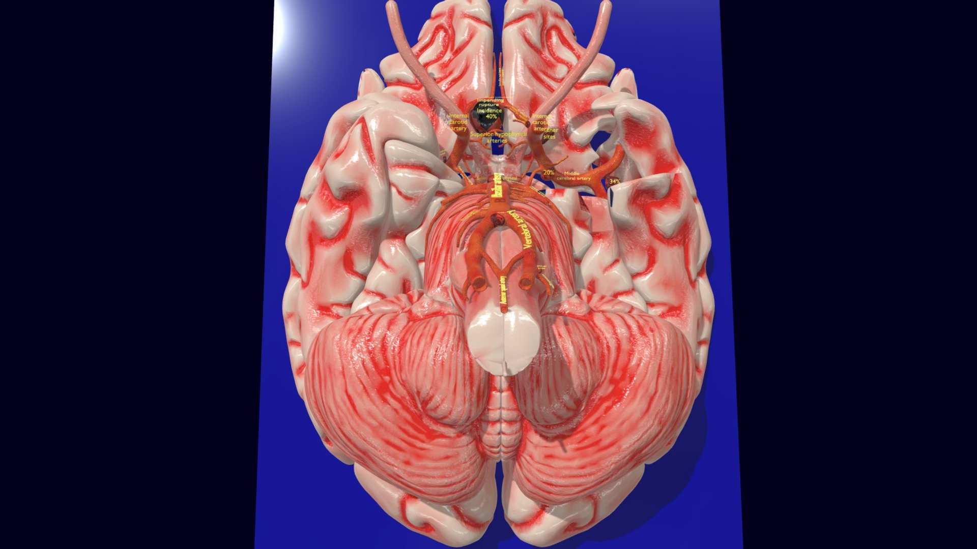 cerebral aneurysms berry circle of willis - Buy Royalty Free 3D model ...