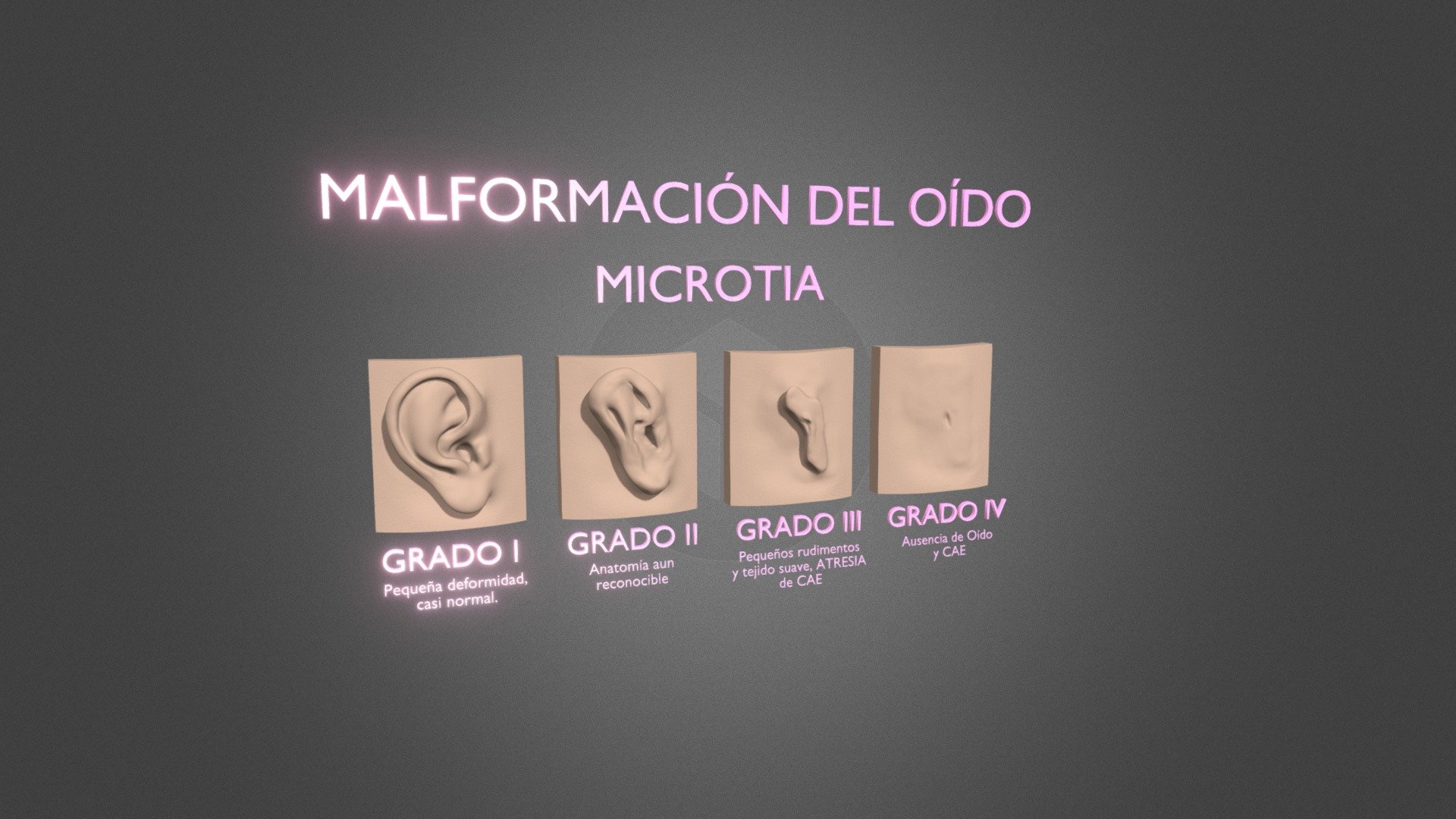 MALFORMACIÓN CONGÉNITA DEL OÍDO - MICROTIA - 3D model by Angélica ...