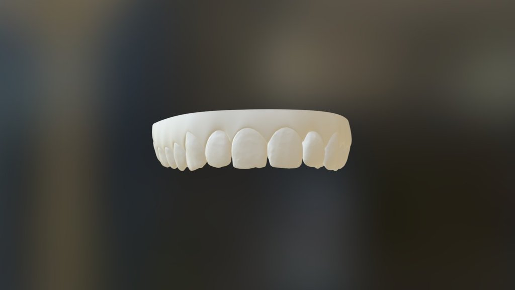 Invisalign (Finish) - 3D model by profilodental [d7d0098] - Sketchfab