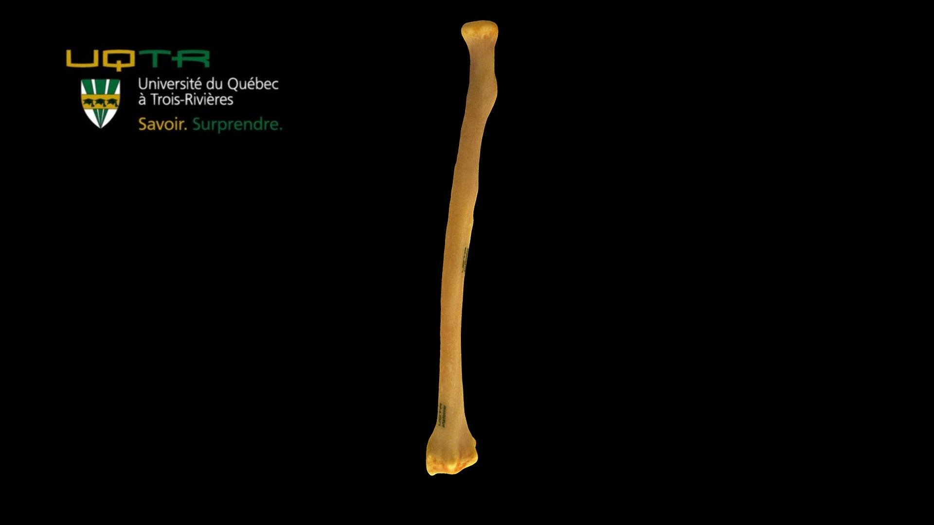 Radius gauche / Left radius - 3D model by Anatomie UQTR - Anatomy UQTR ...