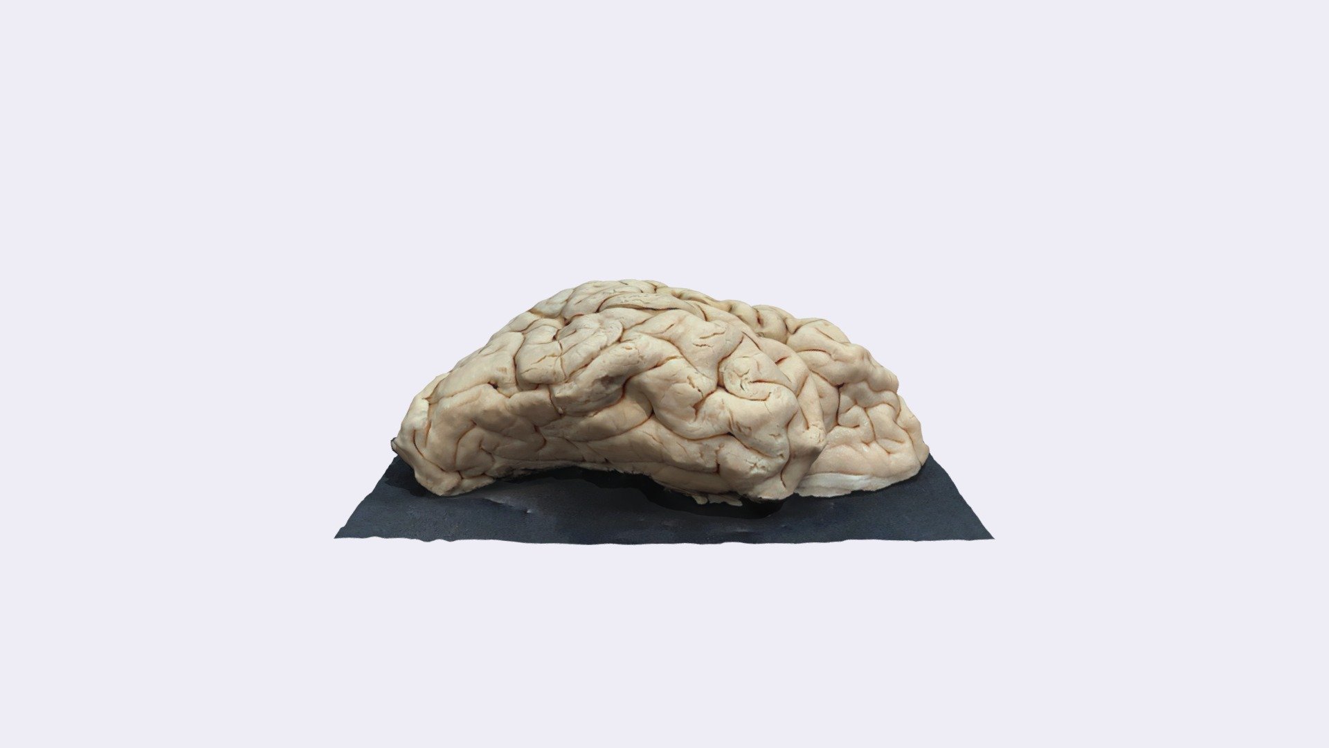 Cadaveric human brain, Right hemisphere - 3D model by Istanbul ...