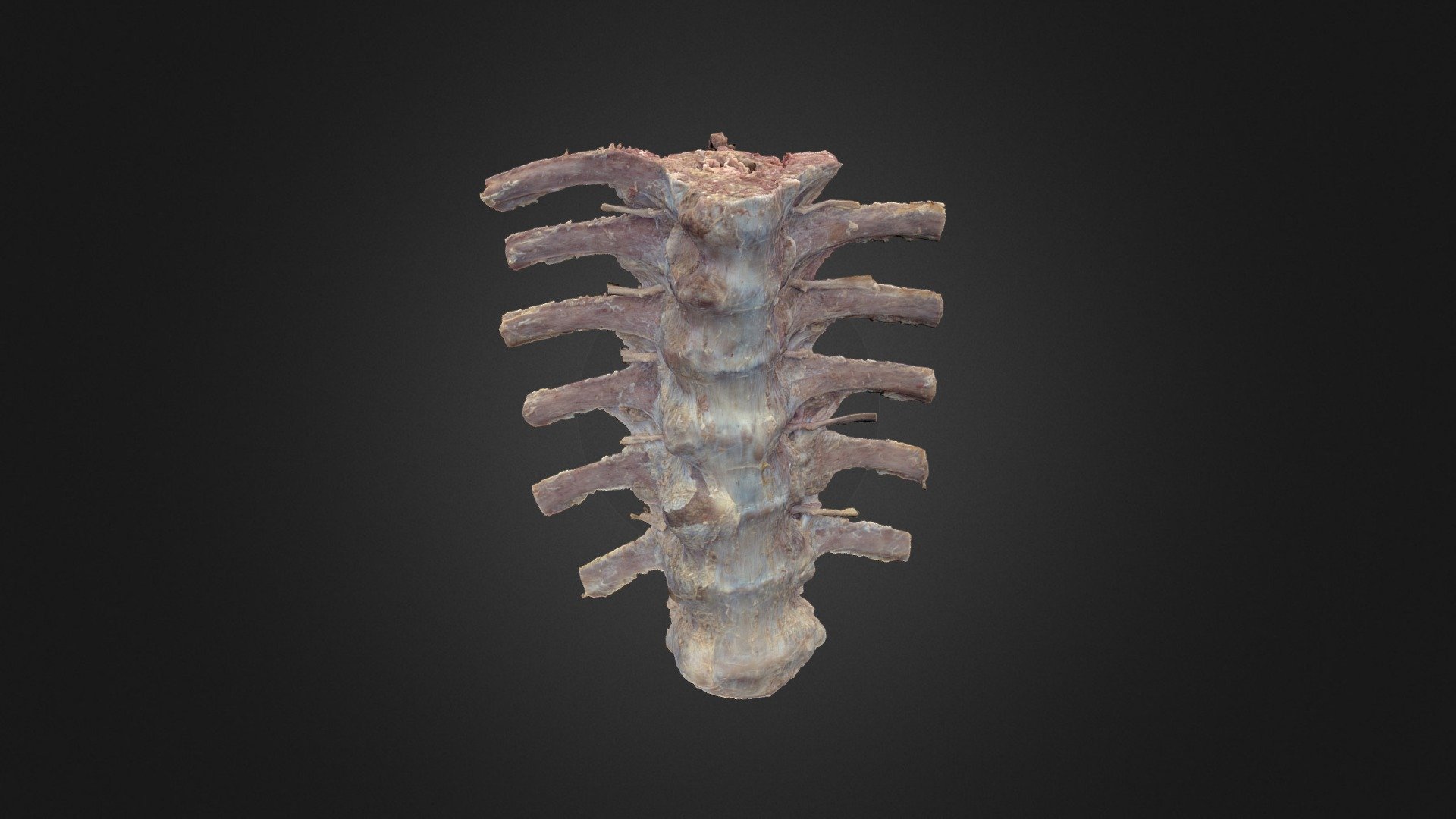 Thoracic Vertebrae with Ribs - 3D model by UBC Medicine - Educational ...