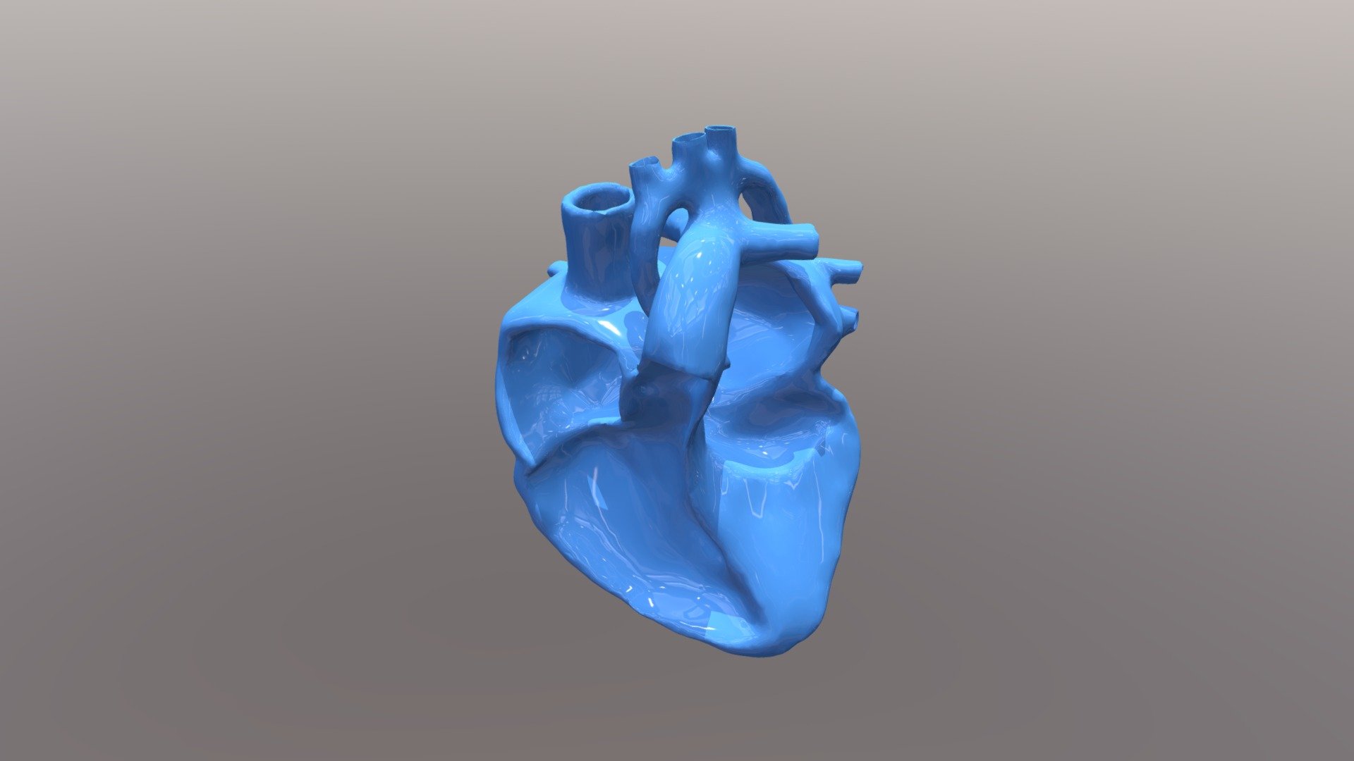 Hypoplastic Left Heart Syndrome - 3D model by tnisi6789 [d8cc263 ...