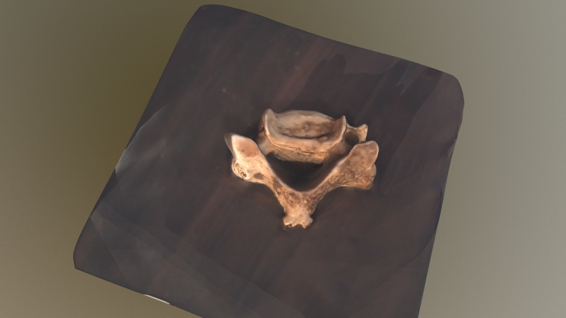Vértebra cervical - 3D model by carocesar [d8e8694] - Sketchfab