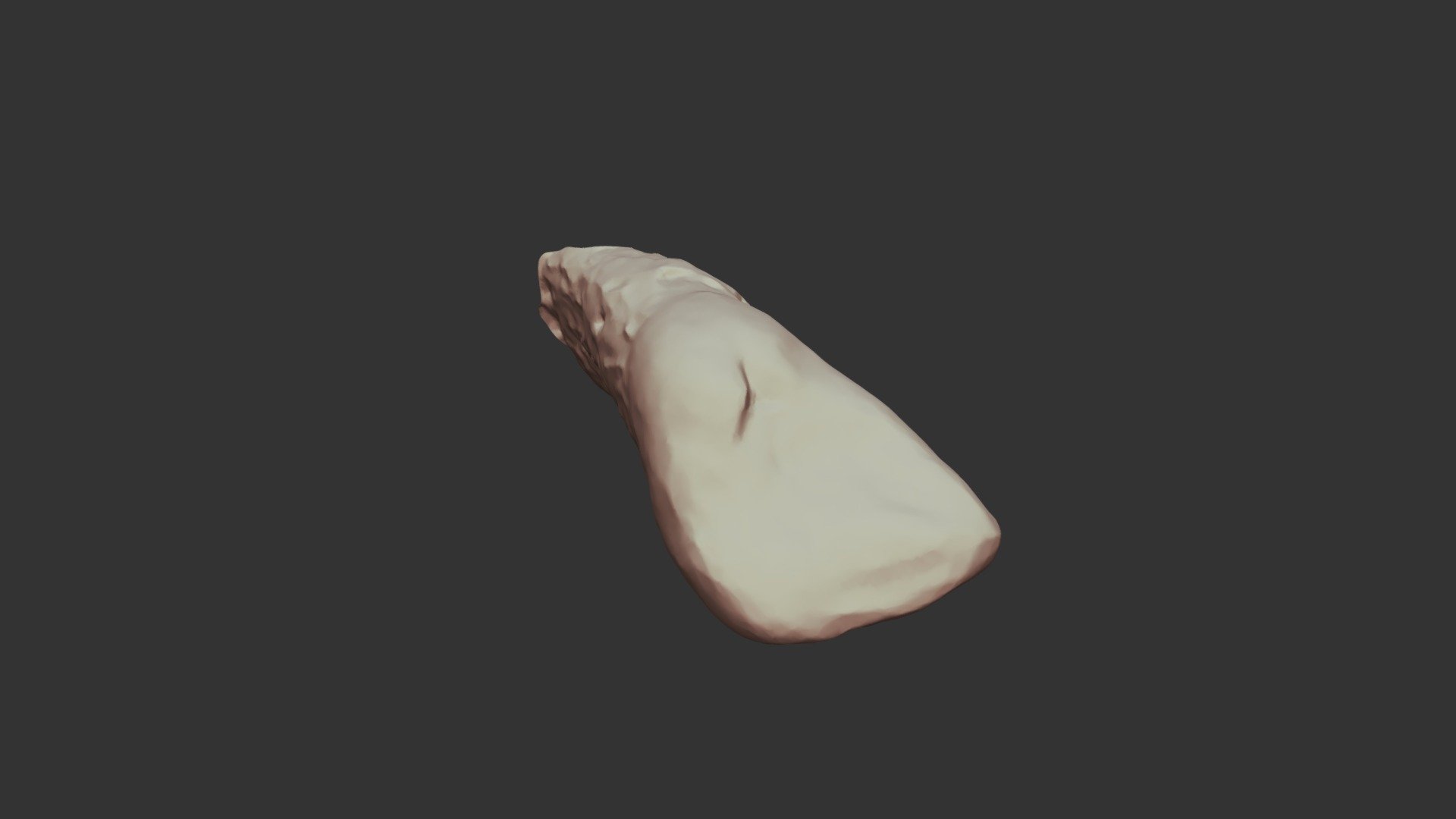 Tooth 10, Group 16, Scanner 2 - 3D model by UMdental [d92a520] - Sketchfab