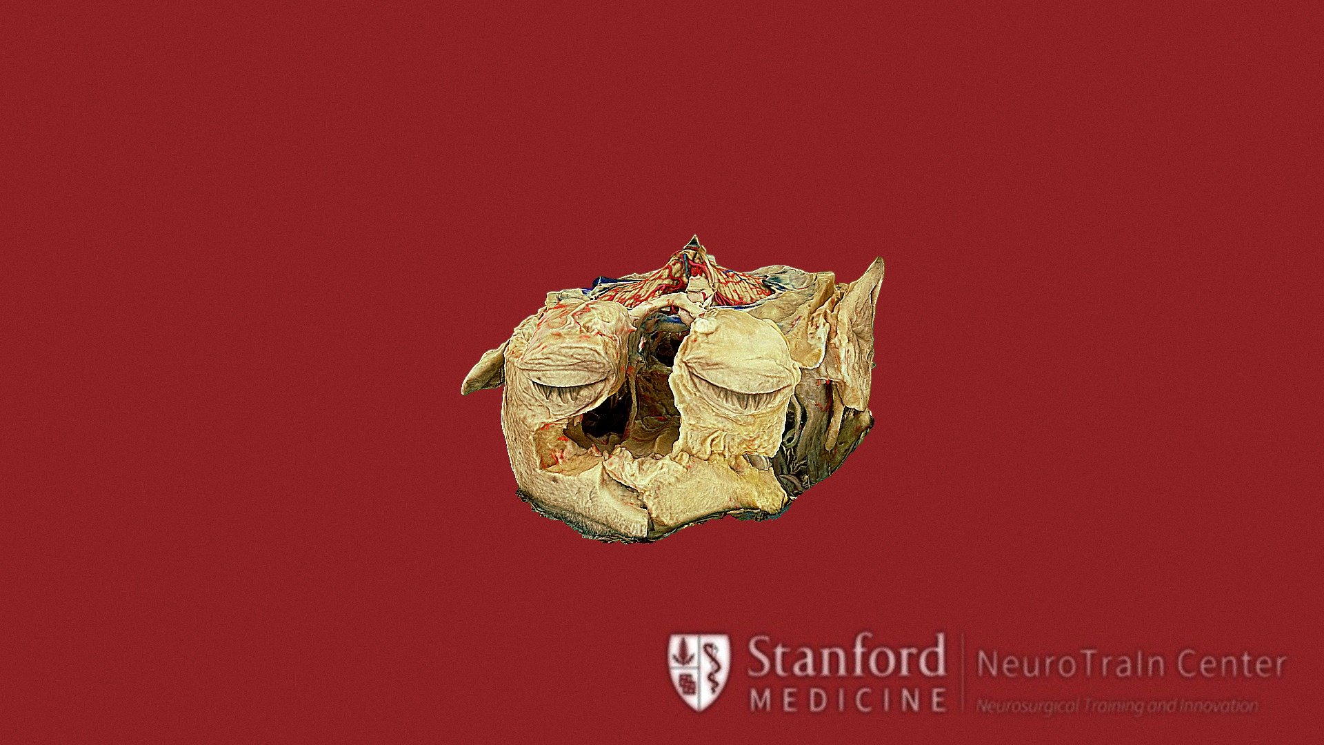 Cavernous sinus - 3D model by vv (@verav) [d96ac35] - Sketchfab