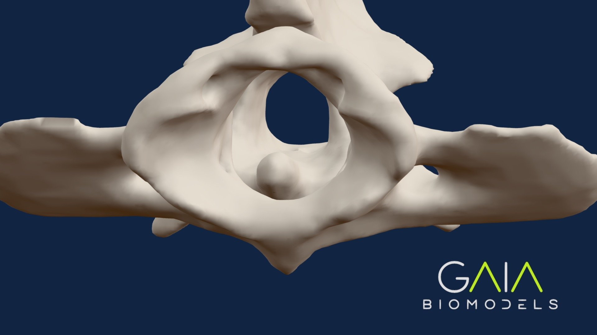 Atlas & axis - DOG - 3D model by GAIA Biomodels (@GaiaBiomodels ...