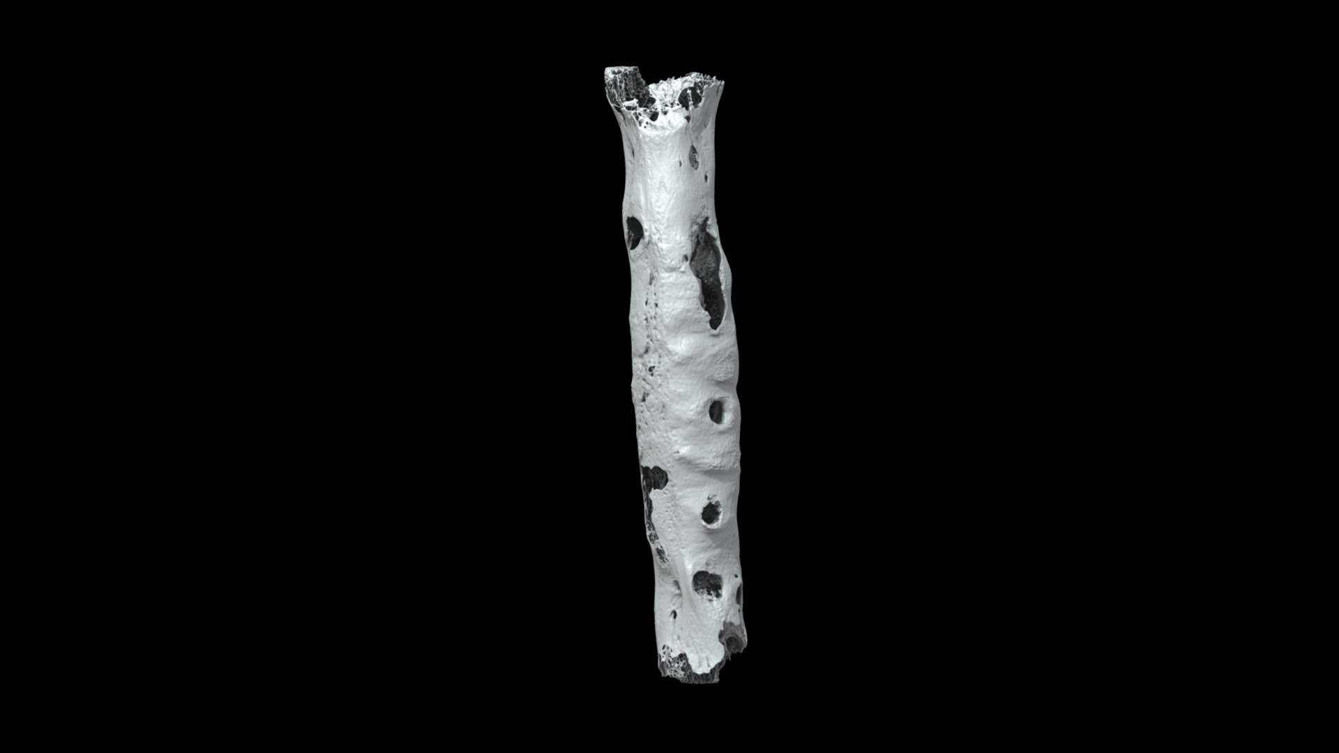 Right tibia with osteomyelitis (VCU_3D_5293) - 3D model by Virtual ...