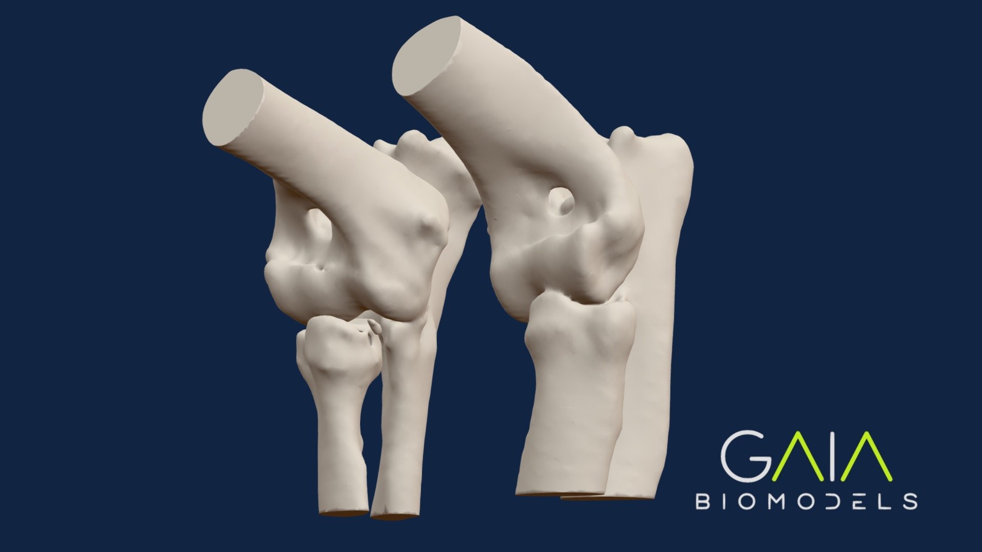 Elbow dysplasia (FCP) - DOG - 3D model by GAIA Biomodels ...