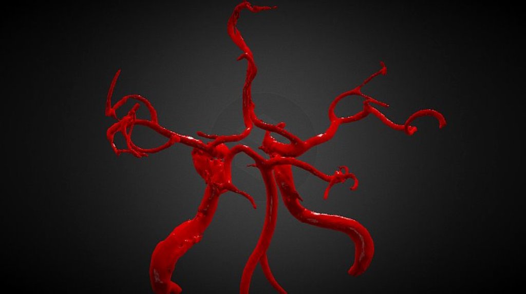 Poligono de Willis - 3D model by Núcleo Diagnóstico (@nucleoradiologico ...