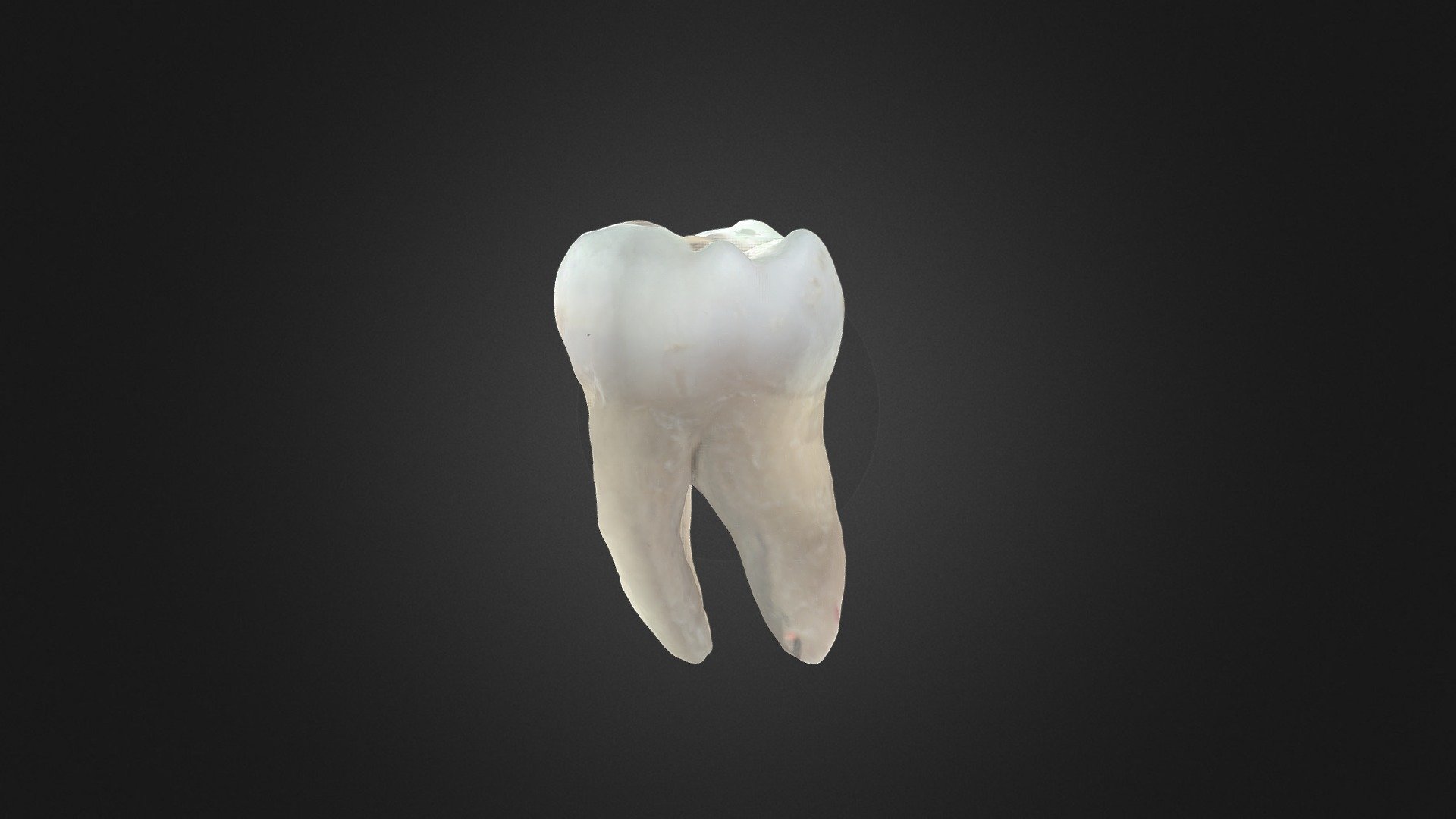 Dente 36 - Lower Left First Molar (ID 36a) - Download Free 3D model by ...