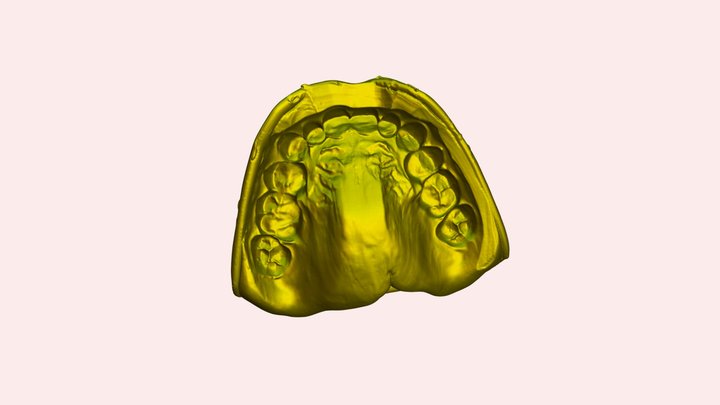 Denture 3D models - Sketchfab
