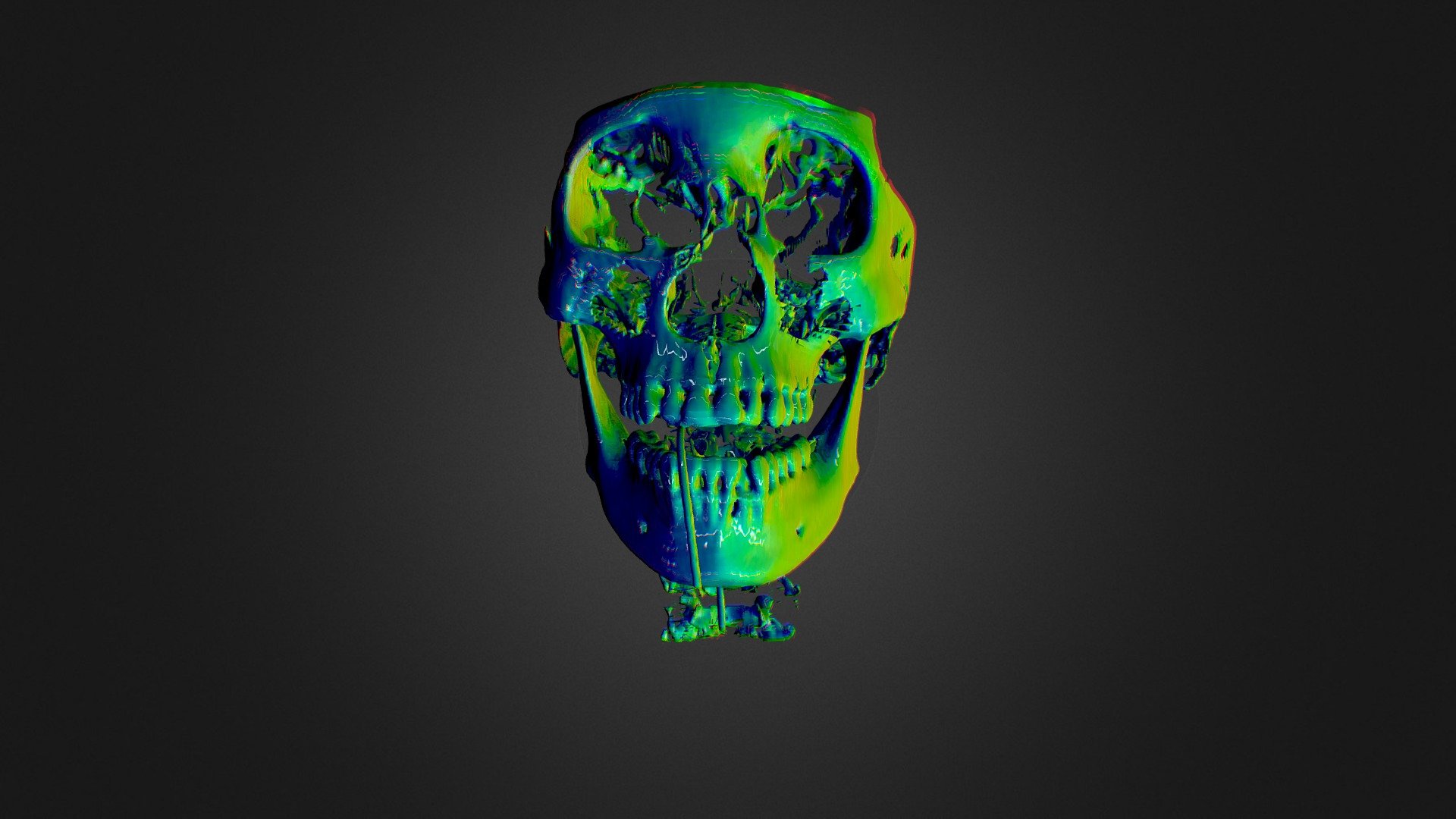 Human Skull - 3D model by calvmill [da5aa01] - Sketchfab