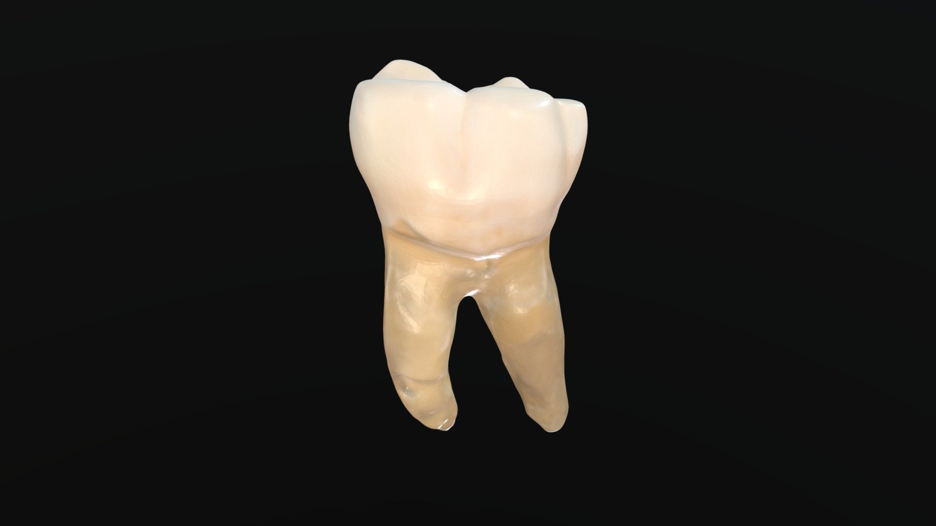 Primer molar mandibular izquierdo (3.6) - 3D model by GIDPTD [da76e1d ...