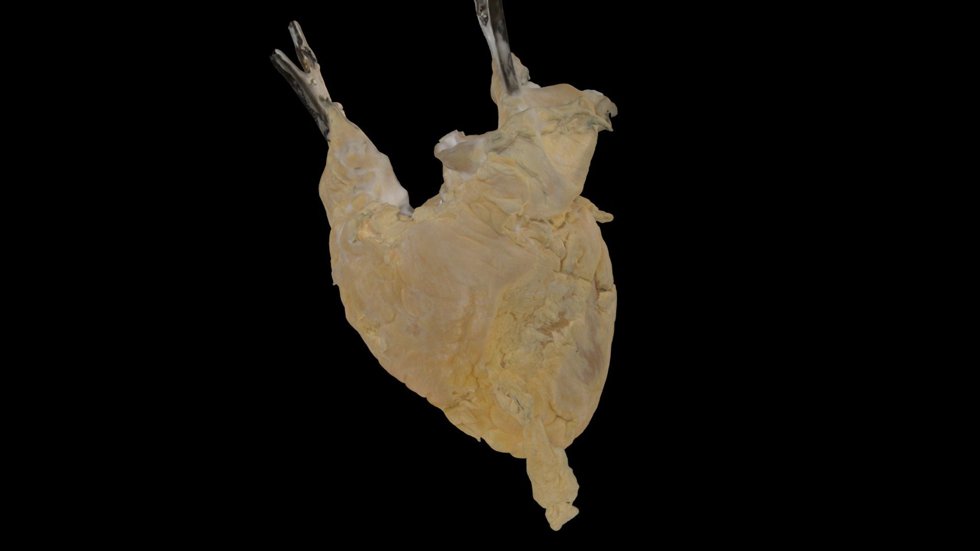 Human Heart Donation 6 - Download Free 3D model by VisibleHeartLabs ...