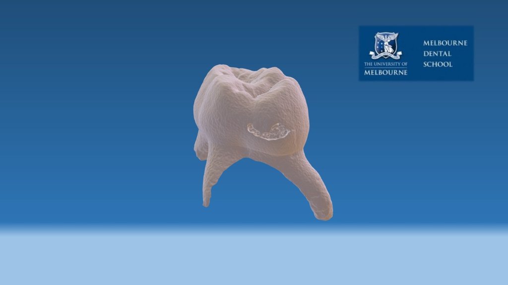 Human deciduous molar - Download Free 3D model by Melbourne Dental ...