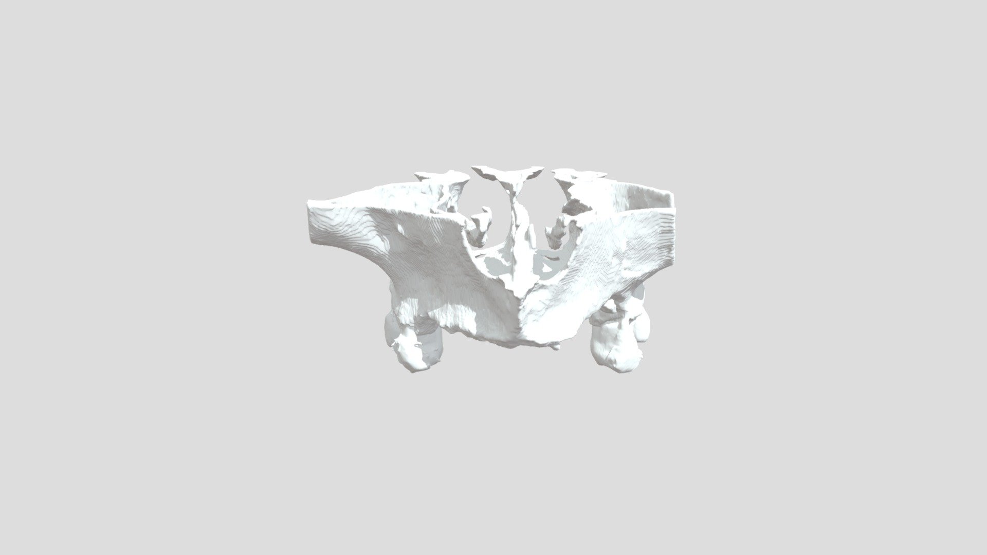 Maxila - 3D model by MD3Dprint [dac0b0f] - Sketchfab