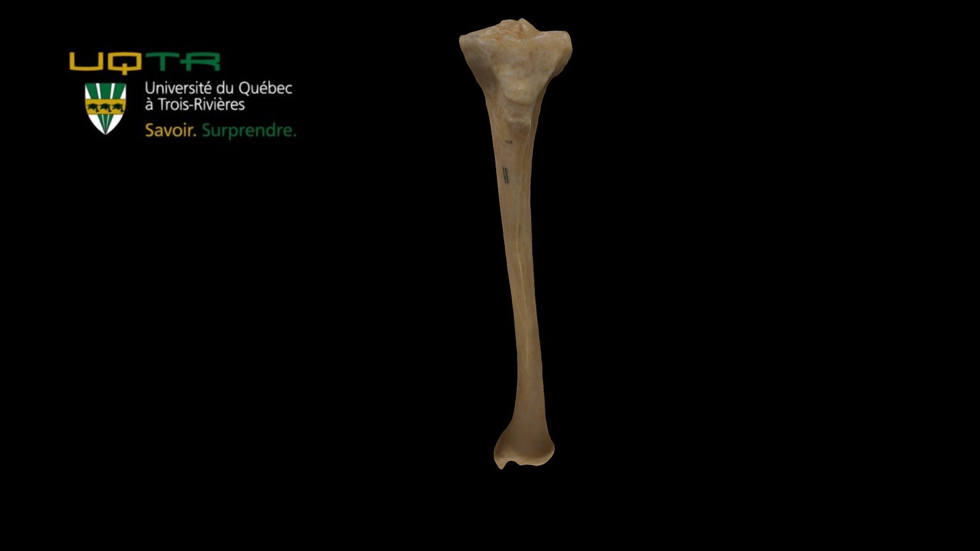 Tibia gauche / Left tibial bone - 3D model by Anatomie UQTR - Anatomy ...