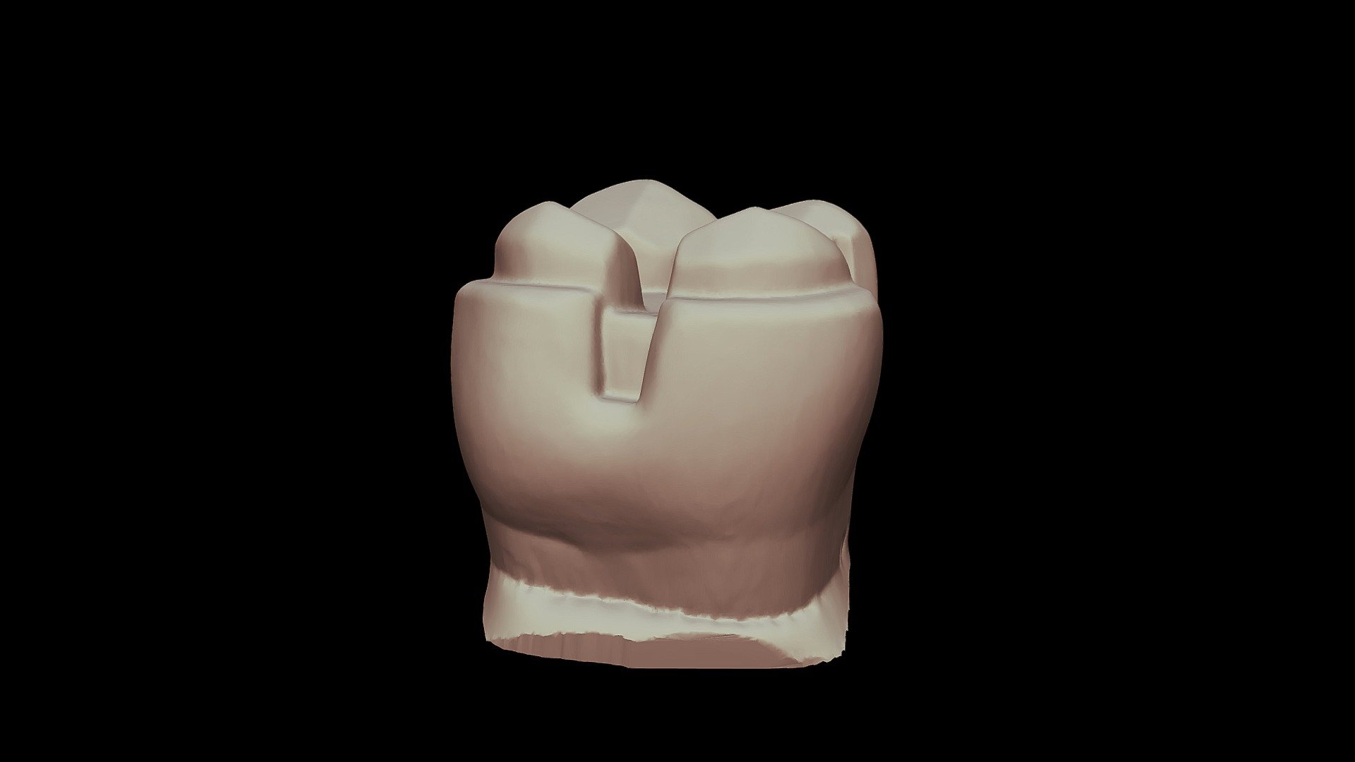 MOD GOLD Onlay - 3D model by bchui [db4237b] - Sketchfab